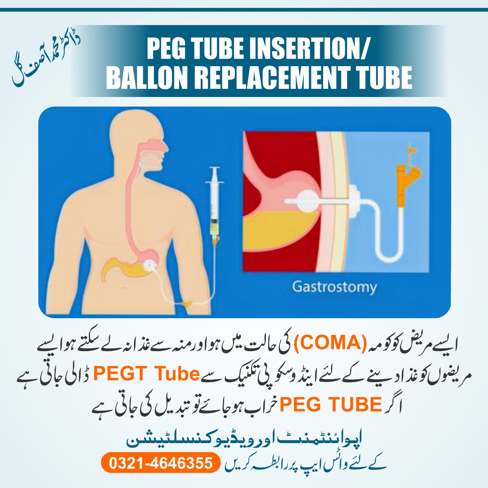 PEG Tube Insertion Drmasifgul PEG Tube Insertion Drmasifgul